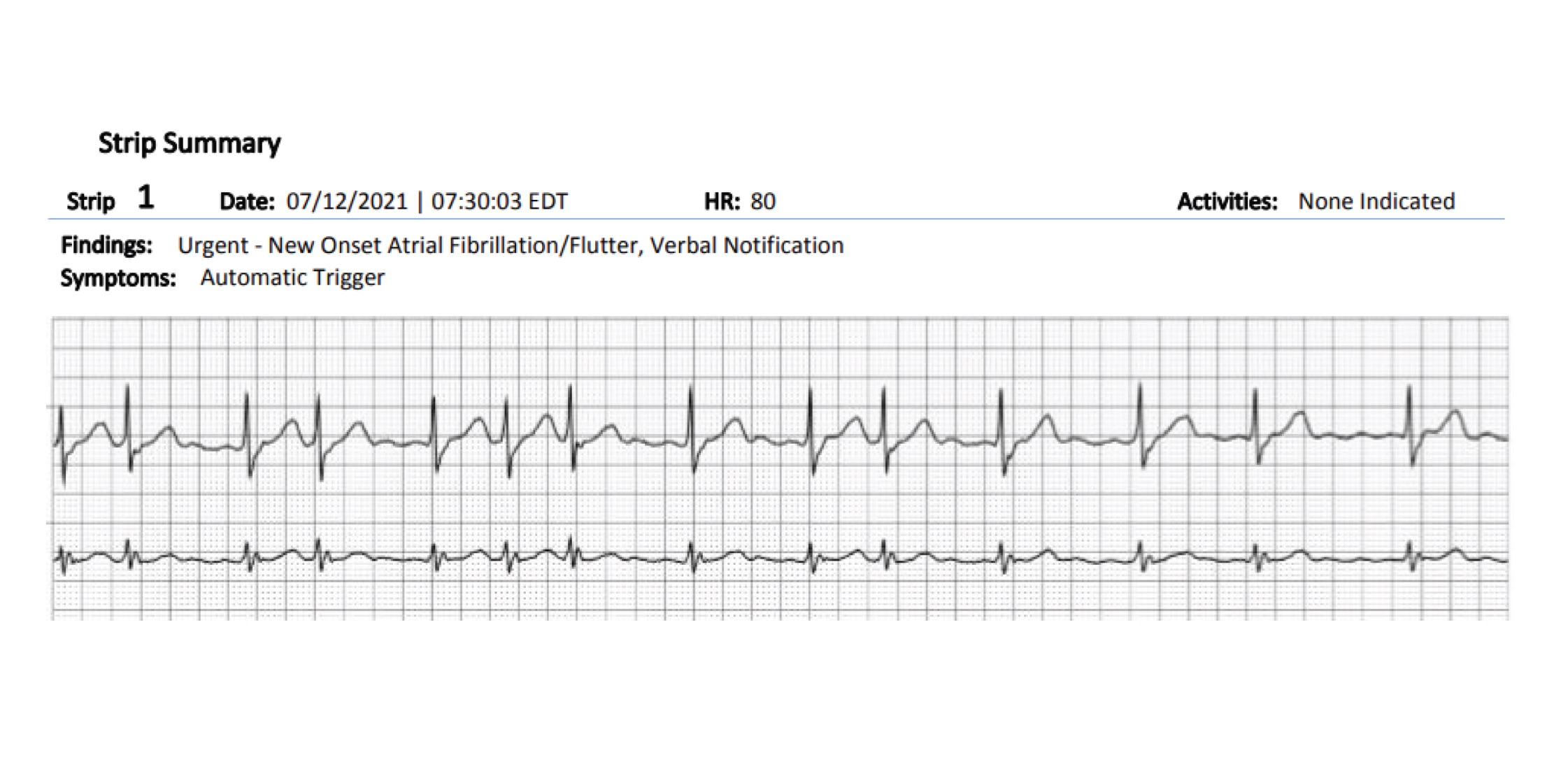 patient-ecg-strip-summary – BioTelemetry, a Philips company