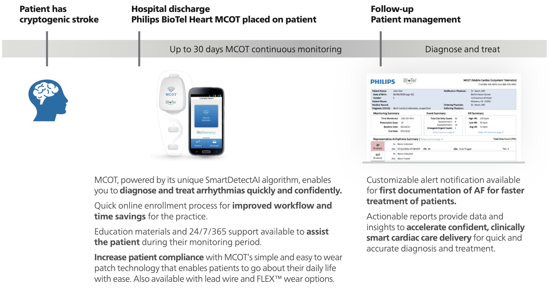 Clinical Pathway – Stroke – BioTelemetry, a Philips company
